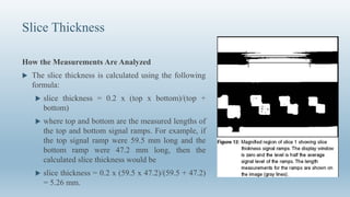 Quality Control in MRI- Avinesh Shrestha | PDF