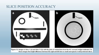 Quality Control in MRI- Avinesh Shrestha | PDF