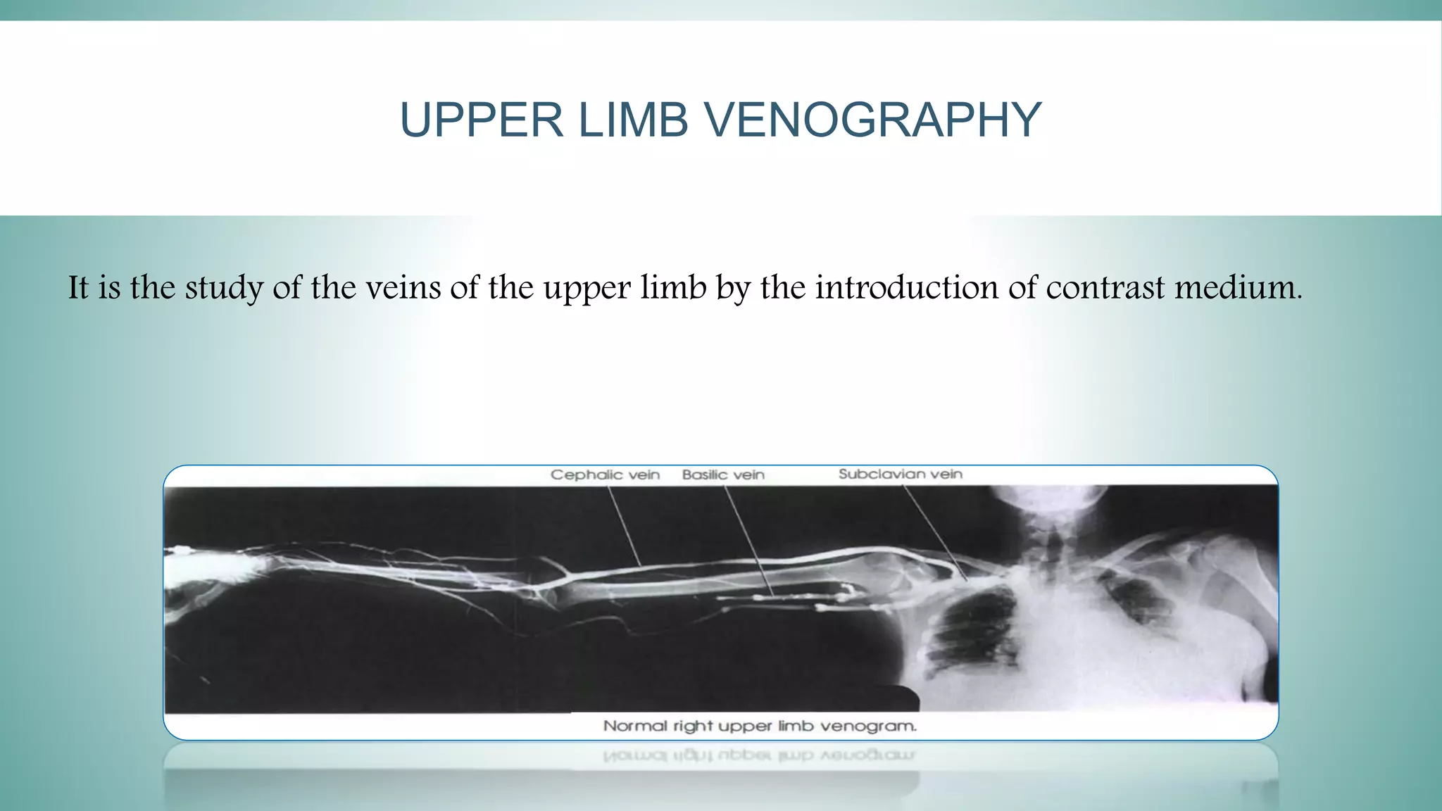 Venography/ Phlebography- Avinesh Shrestha | PPTX