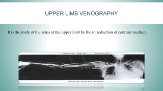 Venography/ Phlebography- Avinesh Shrestha | PPTX