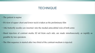 Venography/ Phlebography- Avinesh Shrestha | PPTX