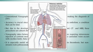 Venography/ Phlebography- Avinesh Shrestha | PPTX