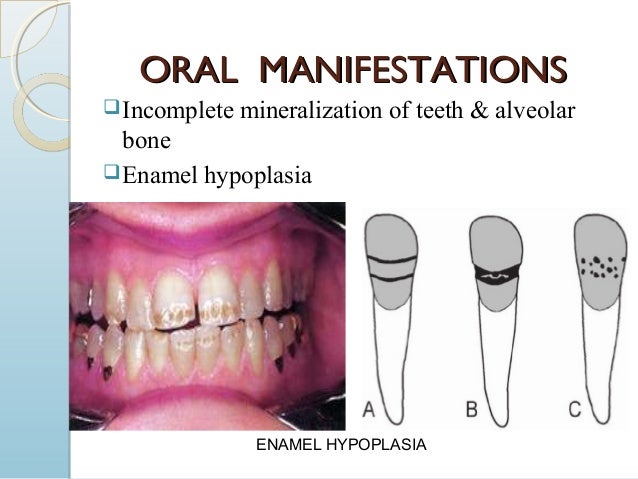 What Does Dependent Lividity Mean