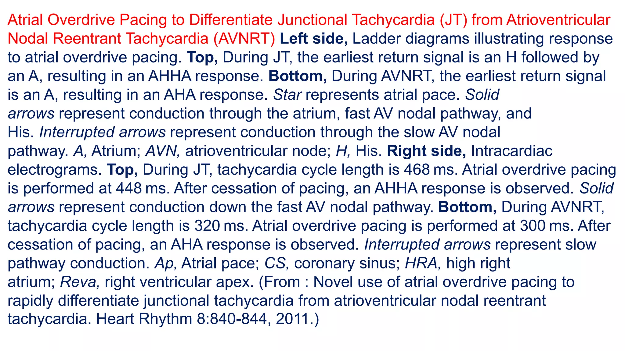 AV junctional Rhythm disturbances.pptx