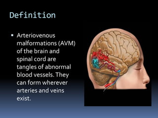 Thyroid ppt | PPTX
