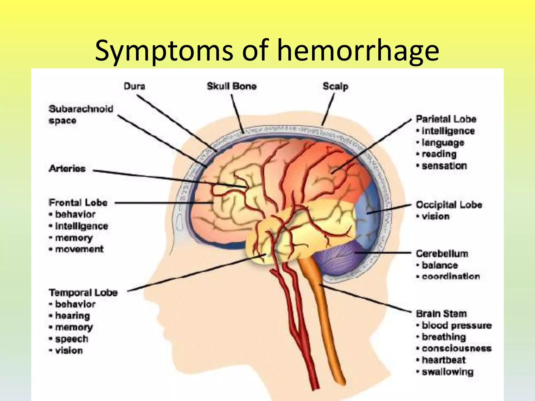 Arteriovenous Malformation (AVM) of Brain | PPTX