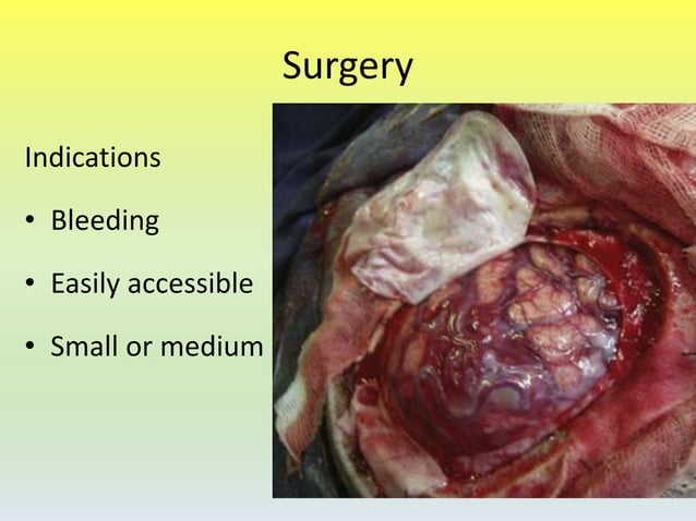 Arteriovenous Malformation (AVM) of Brain | PPTX