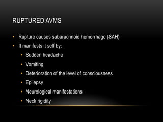 ARTERIO-VENOUS MALFORMATIONS OF THE BRAIN | PPT