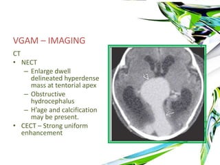 Vascular Malformations Of CNS Radiology | PPTX