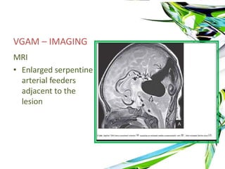 Vascular Malformations Of CNS Radiology | PPTX
