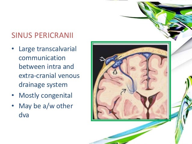 Vascular Malformations Of CNS Radiology