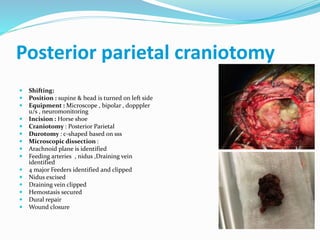 Avm (case presentation)dr.mumtaz ali | PPTX