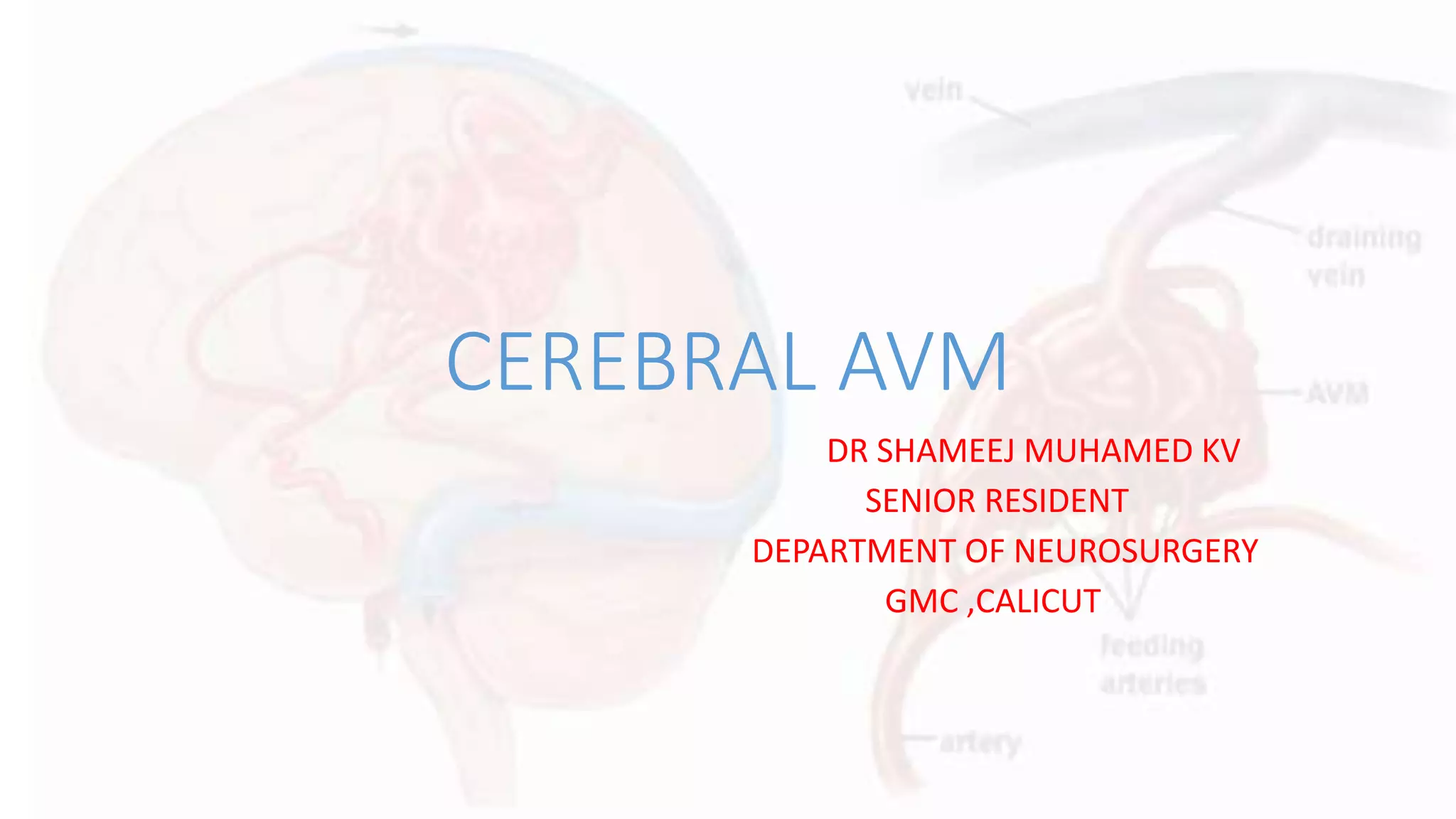 CEREBRAL ARTERIO VENOUS MALFORMATIONS | PPTX