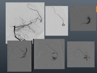 Protocol Based Management of AVM | PPT