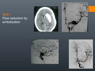 Protocol Based Management of AVM | PPT