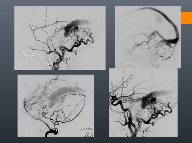 Protocol Based Management of AVM | PPT