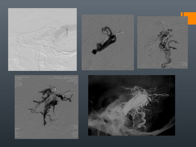 Protocol Based Management of AVM | PPT