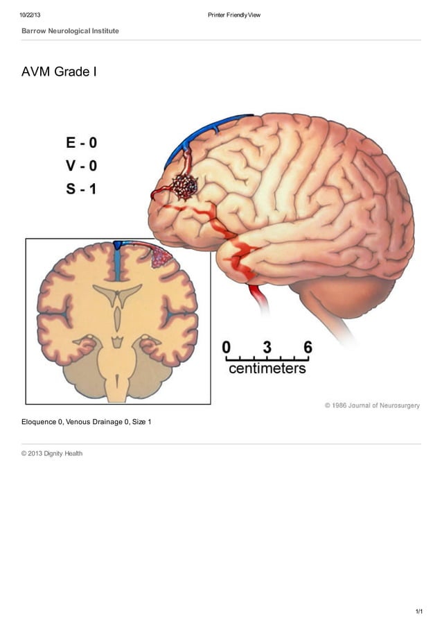Avm spetzler grading | PDF | Diseases and Conditions | Medical Health