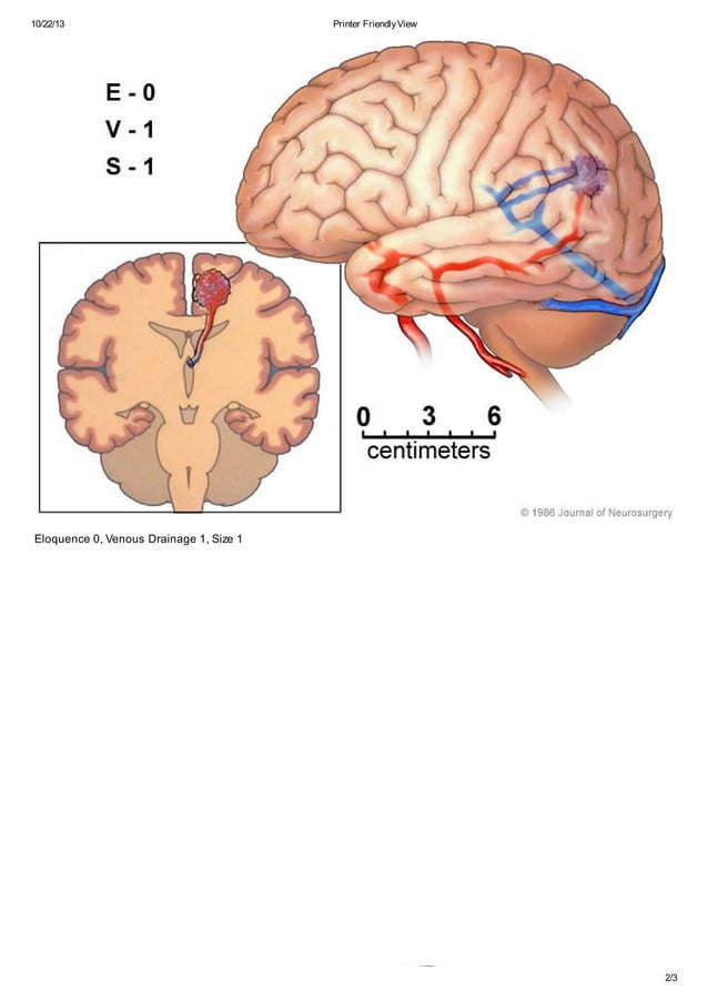 Avm spetzler grading | PDF | Diseases and Conditions | Medical Health