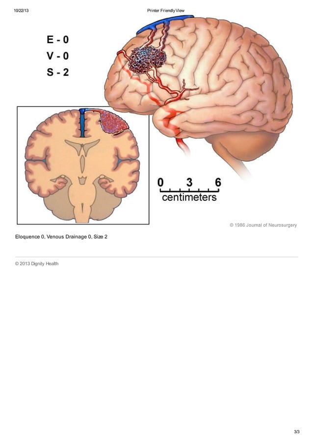 Avm spetzler grading | PDF | Diseases and Conditions | Medical Health