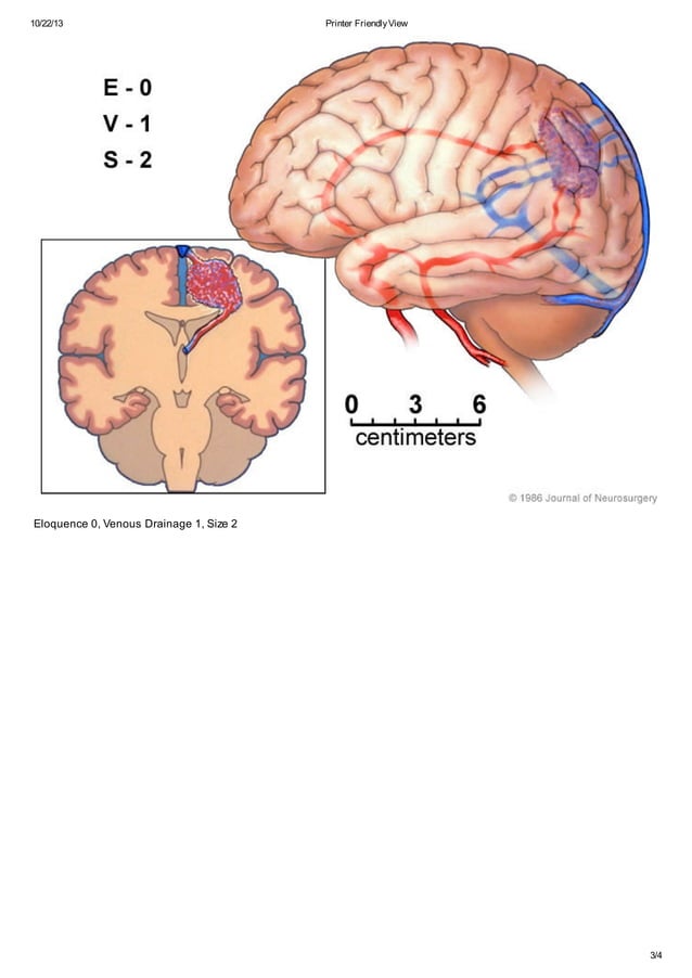 Avm spetzler grading | PDF | Diseases and Conditions | Medical Health