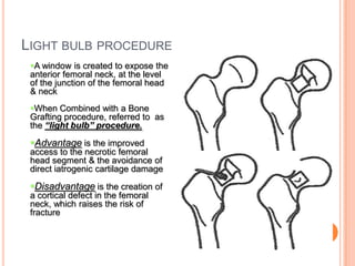 Avascular Necrosis of the Femoral Head | PPTX