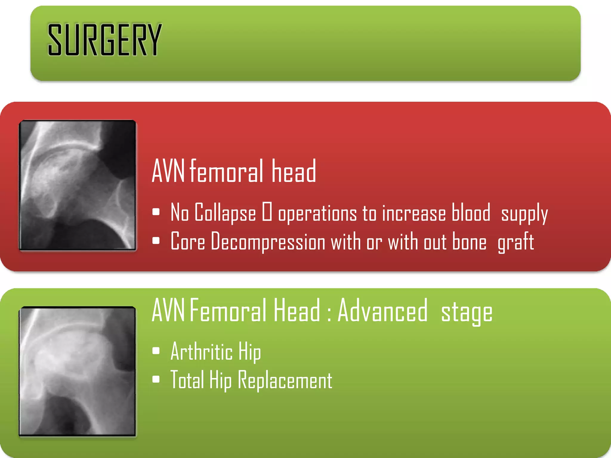 Femoral Head Avascular Necrosis - Dr Rohit Bhaskar | PDF