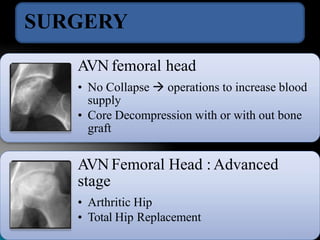 Avascular necrosis of femur | PPTX