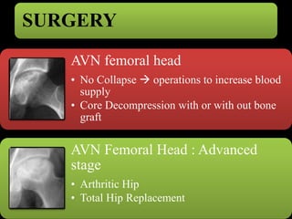 AVASCULAR NECROSIS OF HIP (AVN HIP) | PPTX