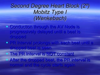 Av nodal blocks | PPT