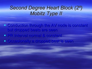 Av nodal blocks | PPT