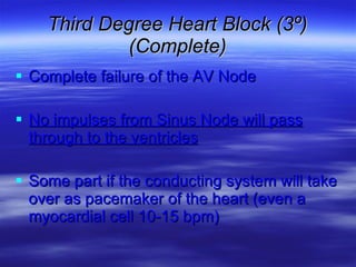 Av nodal blocks | PPT