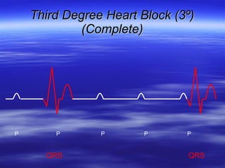 Av nodal blocks | PPT