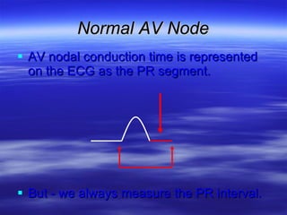 Av nodal blocks | PPT