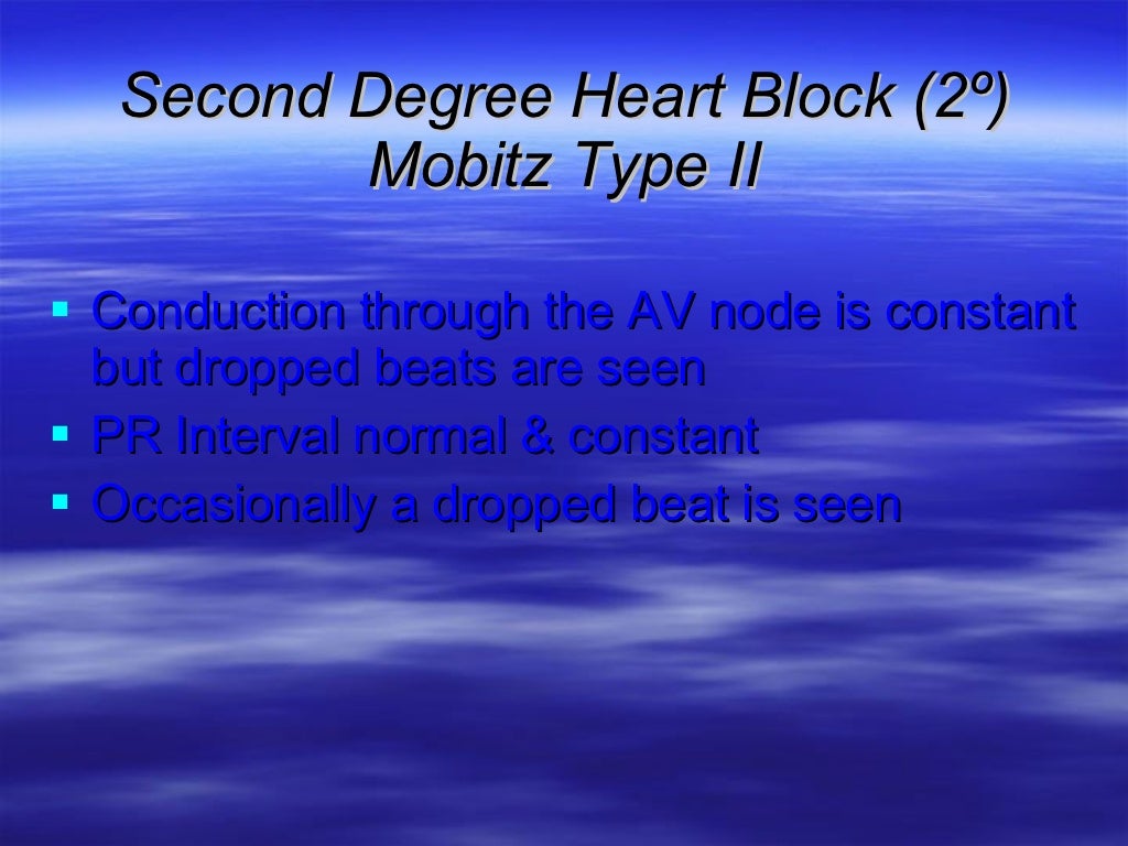 Av Nodal Blocks av-nodal-blocks