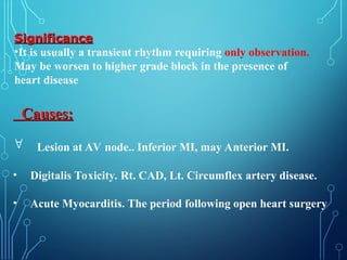 lecture on AV conduction defect of heart | PPT