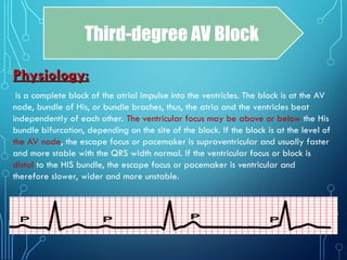lecture on AV conduction defect of heart | PPT