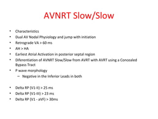 AVNRT | PPT