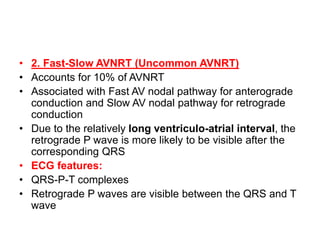 AVNRT,TYPES AND HOW TO INTERPRET IN ECG? | PPTX