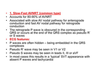 AVNRT,TYPES AND HOW TO INTERPRET IN ECG? | PPTX