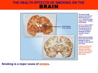 Avoid Smoking | PPT