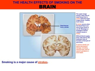 Avoid smoking(collected) | PPT