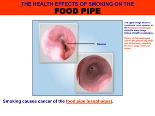 Avoid smoking(collected) | PPT