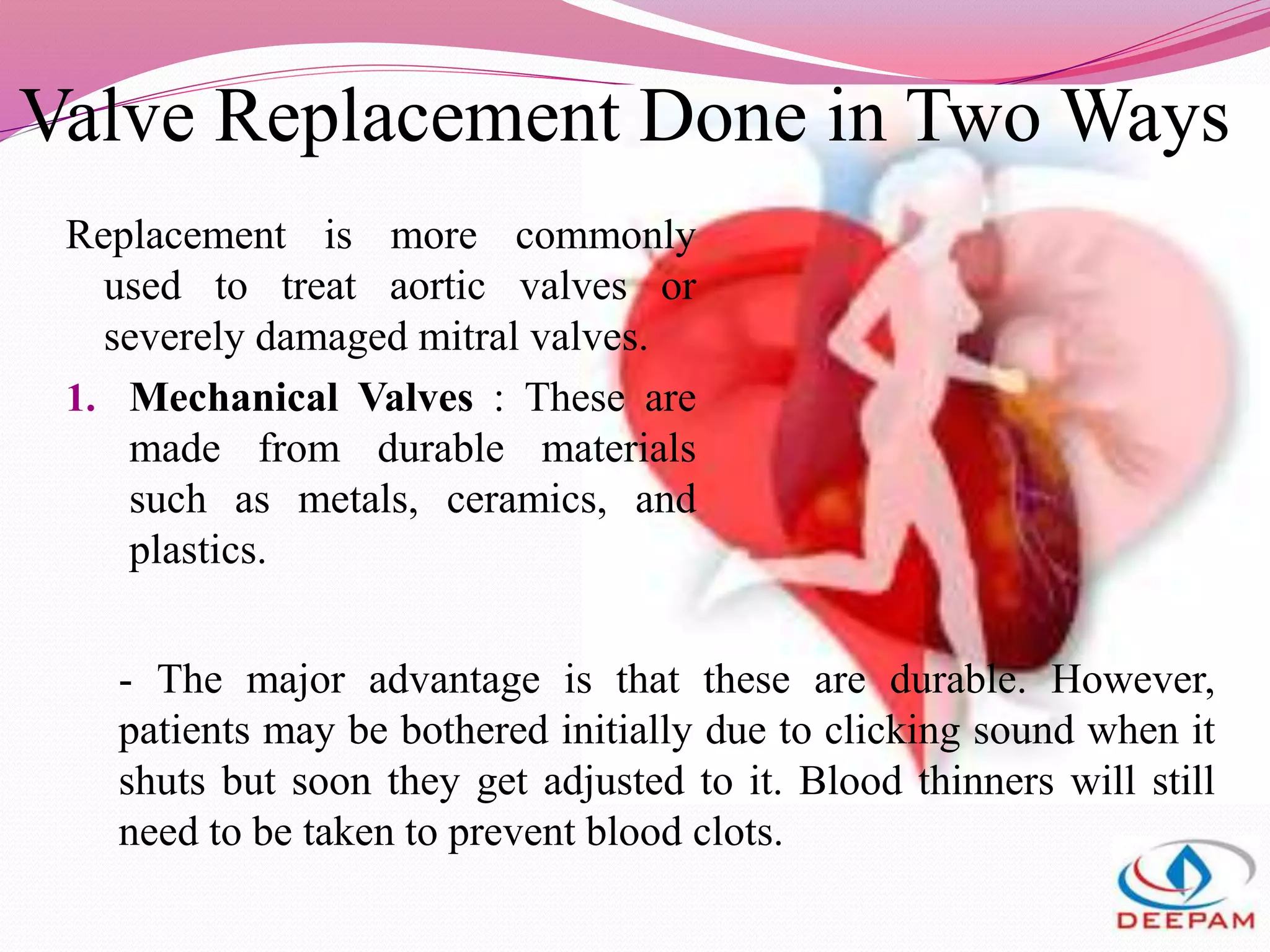 AVR - MVR all you need to know about Valve Repair & Replacement | PPTX
