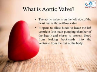 AVR - MVR all you need to know about Valve Repair & Replacement | PPTX