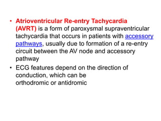 AVRT,TYPES AND HOW TO INTERPRET IN ECG?? | PPTX