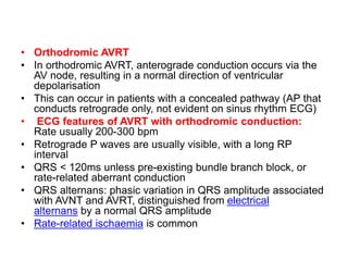 AVRT,TYPES AND HOW TO INTERPRET IN ECG?? | PPTX