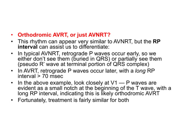 AVRT,TYPES AND HOW TO INTERPRET IN ECG?? | PPTX | Heart and ...