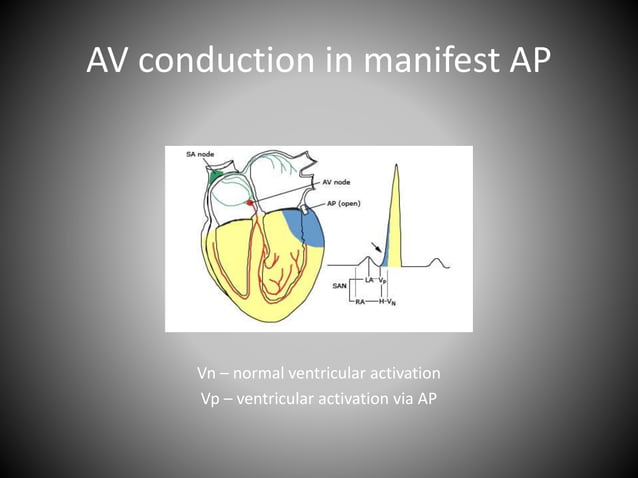 Electrophysiology AVRT | PPTX | Heart and Cardiovascular Diseases ...