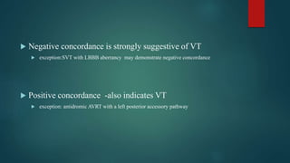 Avrt vz vt | PPTX